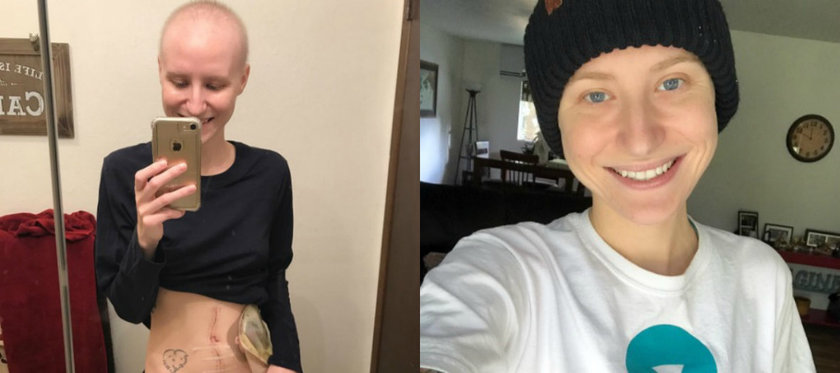 Youtuber fitness compartilha luta contra câncer nas redes sociais